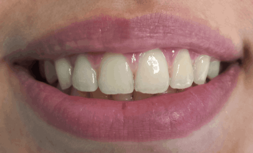 Como Está a Saúde da Sua Gengiva? - Sorriso e Saúde . Net